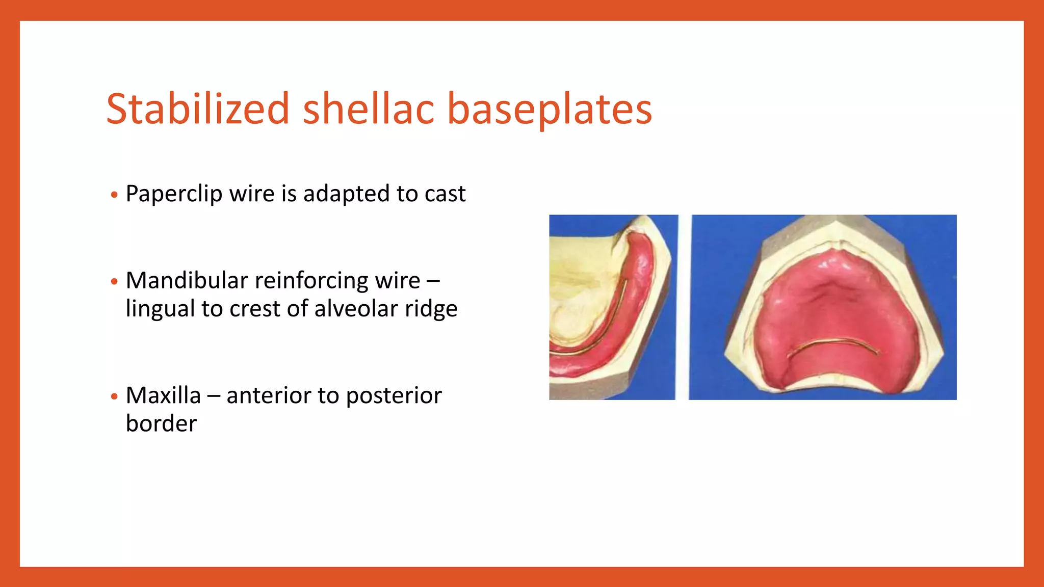 Denture base and occlusal rims | PPTX