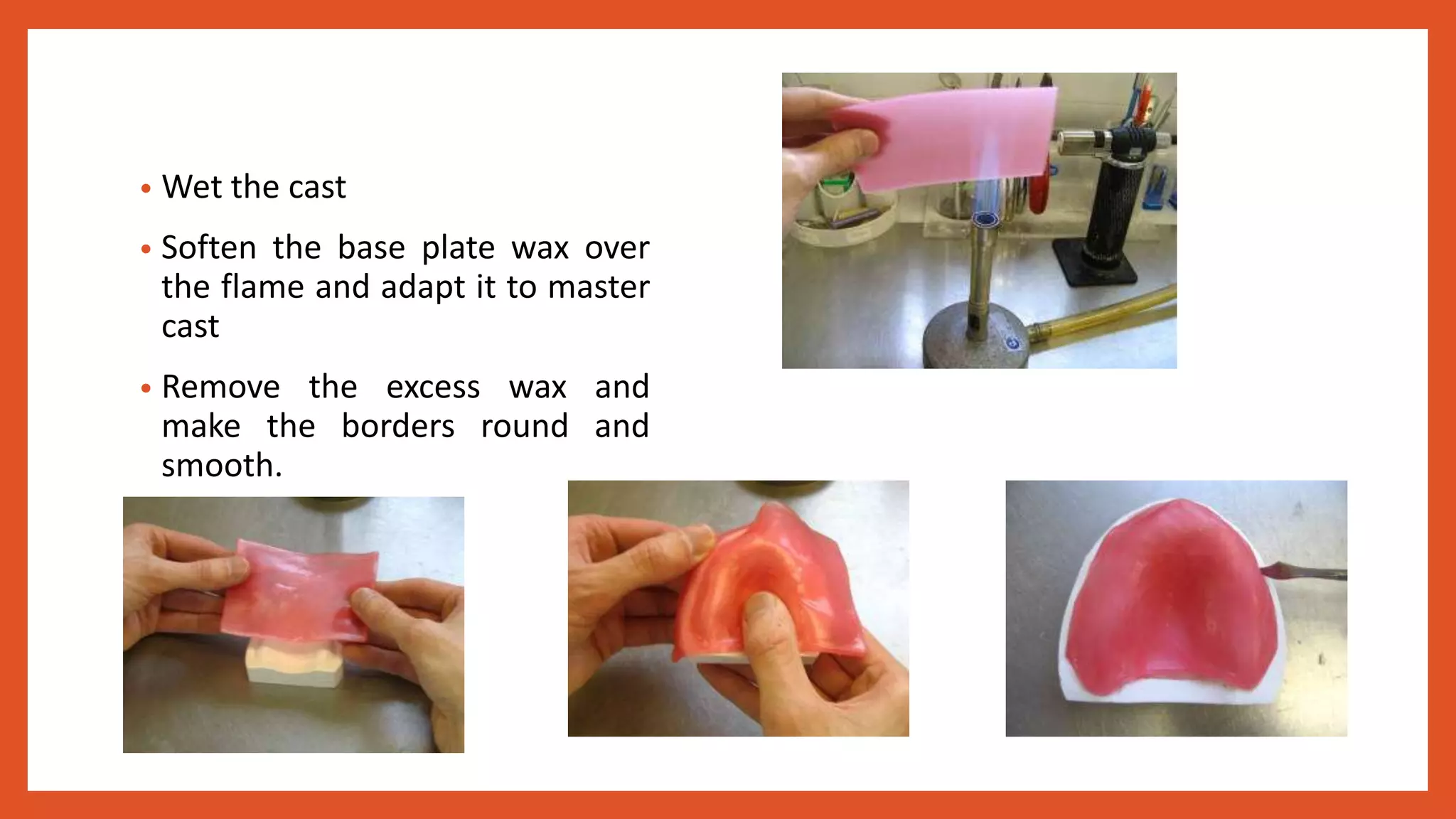 Denture base and occlusal rims | PPTX