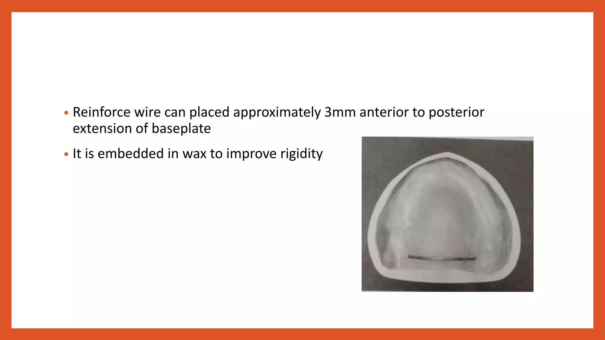 Denture base and occlusal rims | PPTX