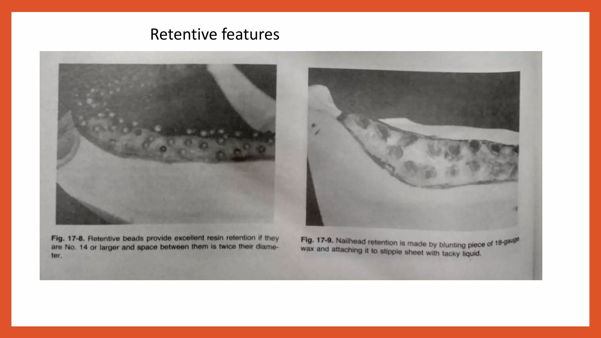 Denture base and occlusal rims | PPTX