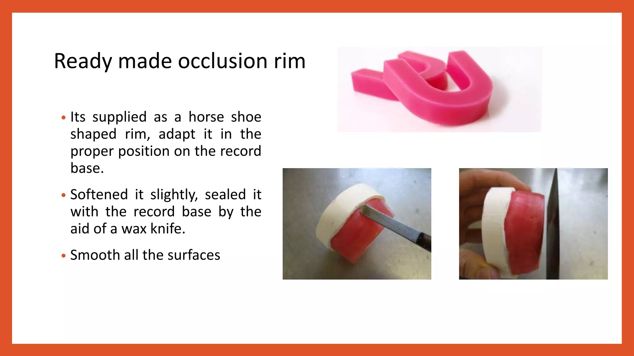 Denture base and occlusal rims | PPTX