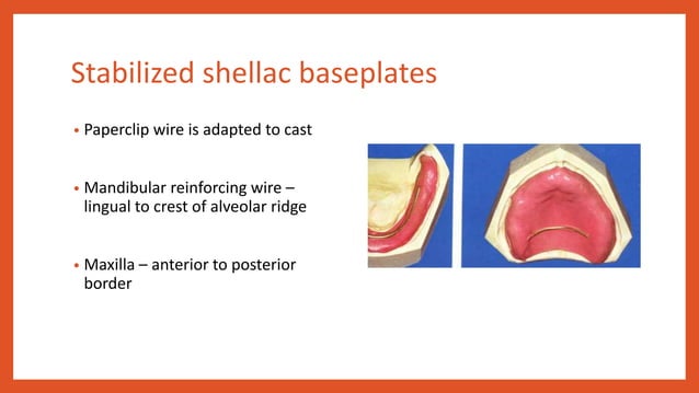Denture base and occlusal rims | PPTX