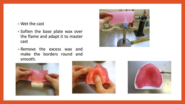 Denture base and occlusal rims | PPTX