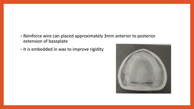Denture base and occlusal rims | PPTX