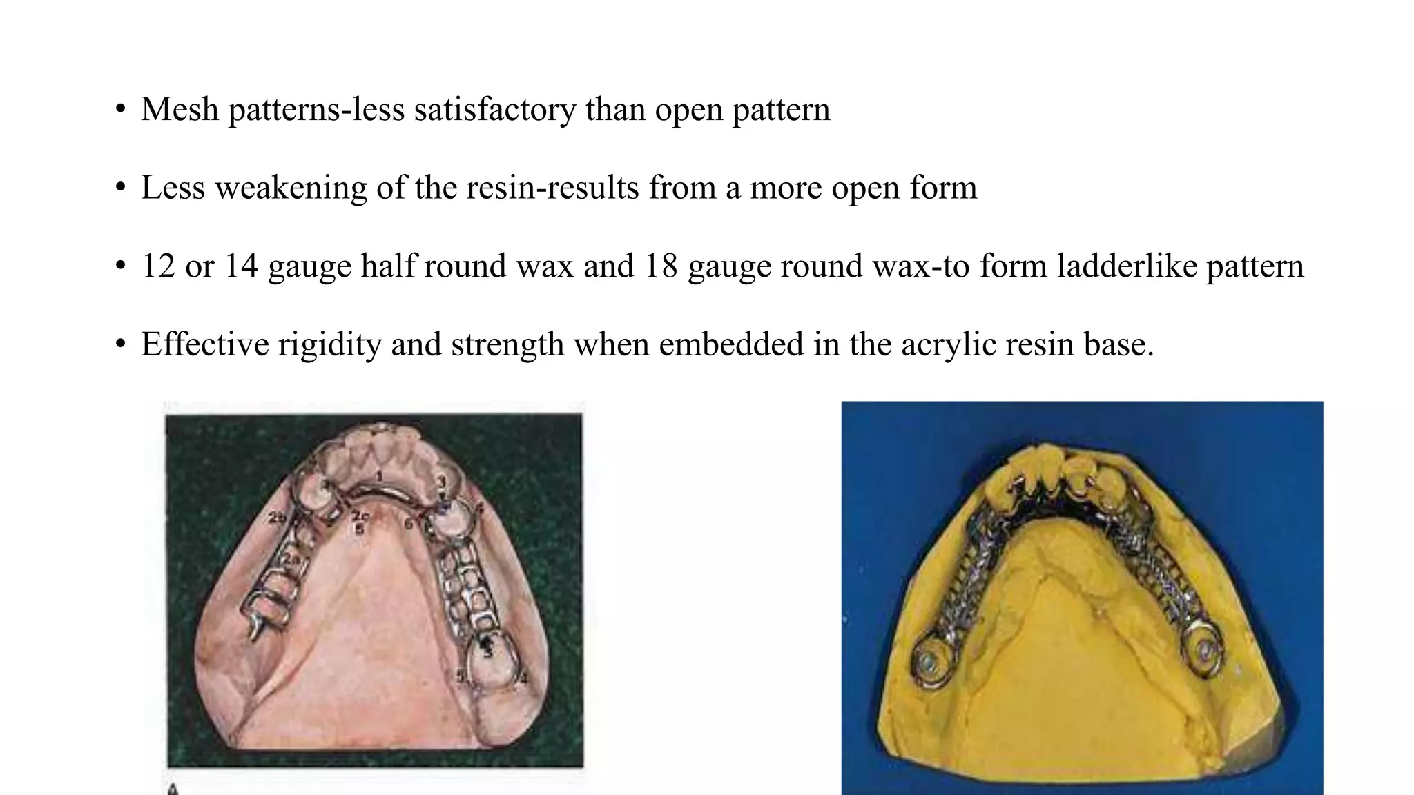 Denture base considerations in rpd | PPTX