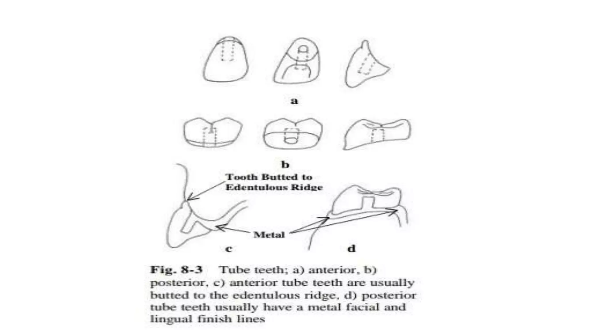 Denture base considerations in rpd | PPTX