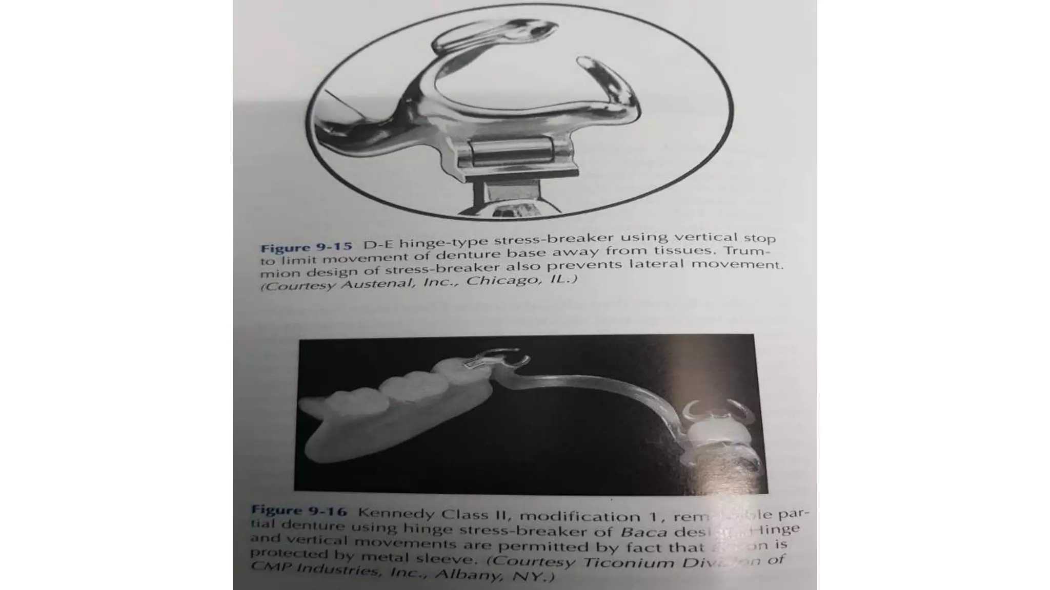 Denture base considerations in rpd | PPTX