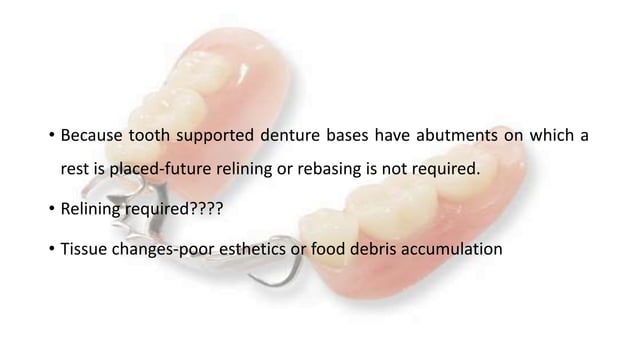 Denture base considerations in rpd | PPTX | Oral care | Personal Care