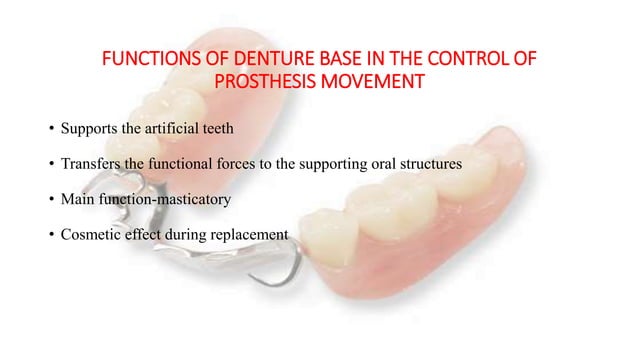 Denture base considerations in rpd | PPTX | Oral care | Personal Care