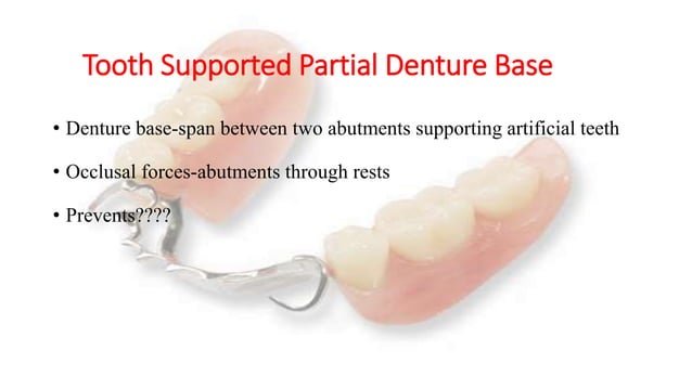 Denture base considerations in rpd | PPTX | Oral care | Personal Care