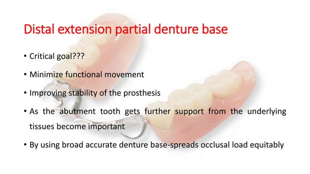 Denture base considerations in rpd | PPTX | Oral care | Personal Care