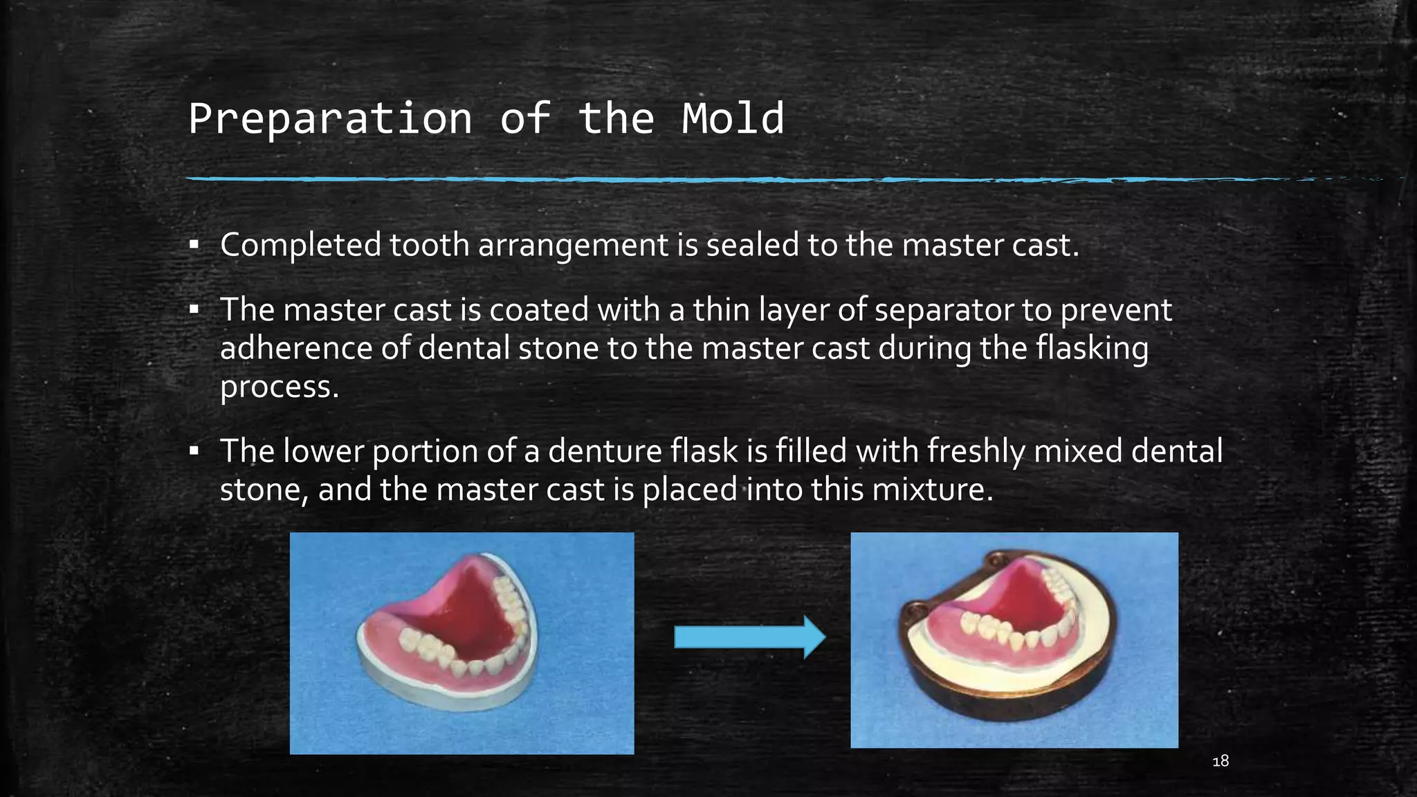 DENTURE BASE MATERIAL.pptx