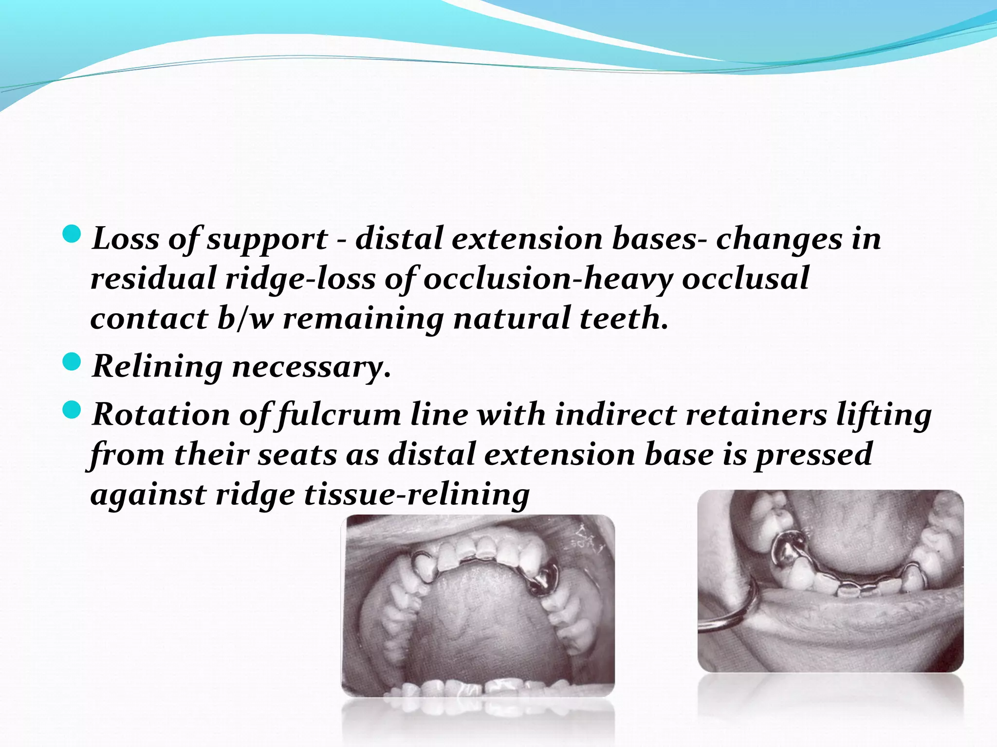 Denture base materials | PPT