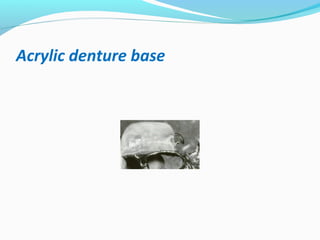 Denture base materials | PPT