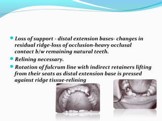 Denture base materials | PPT