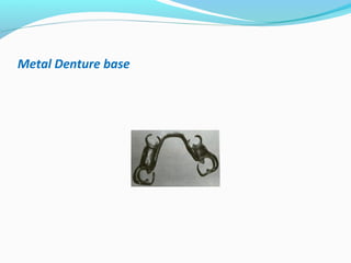 Denture base materials | PPT