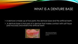 Denture base materials | PPT
