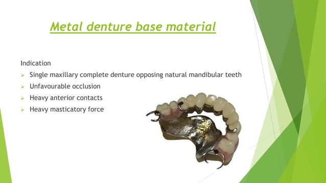 Denture base materials | PPTX