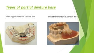 Denture base materials | PPTX