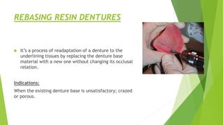 Denture base materials | PPTX