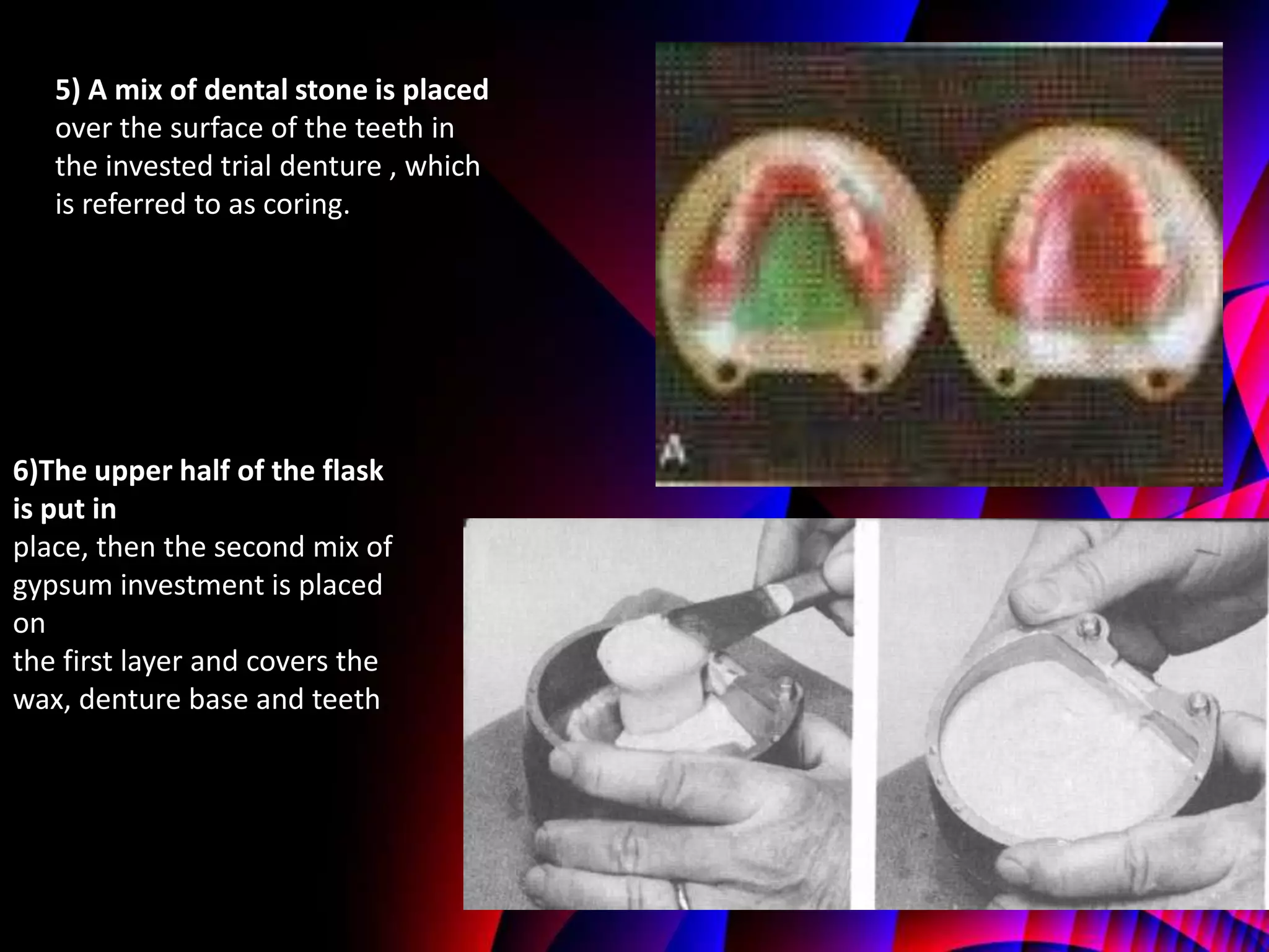 Denture base resins | PPTX