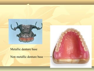 Denture base resins | PPT