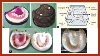 Denture base resins materials and its mechanism of action | PPTX