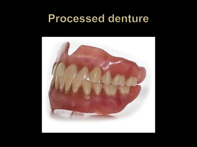 denture_base_resins used in dentistry ppt | PPT