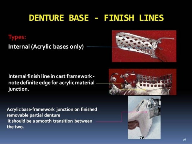 Denture base & Rests & Minor connectors