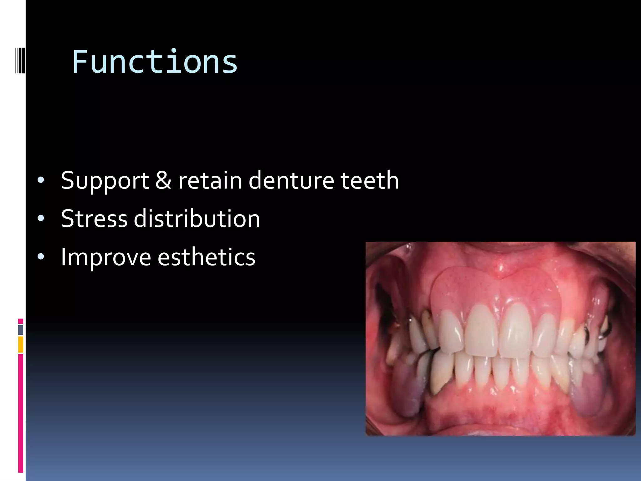 Denture bases | PPTX