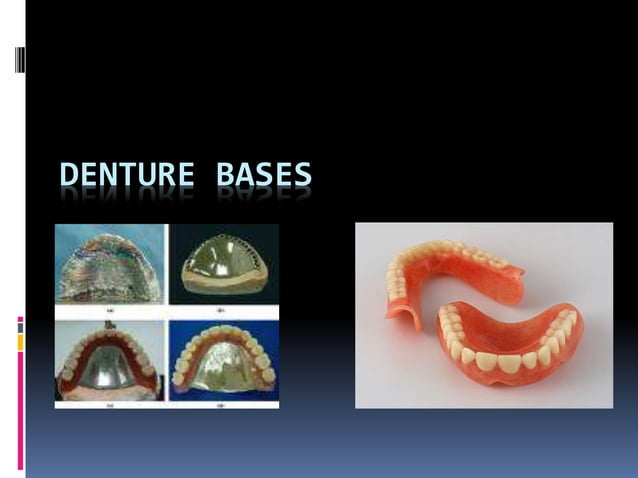 Denture bases | PPTX