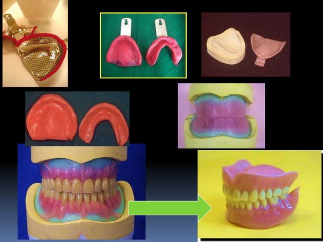 Denture bases | PPTX