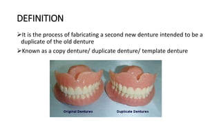 DENTURE COPYING PROCEDURES IN PROSTHETIC | PPTX