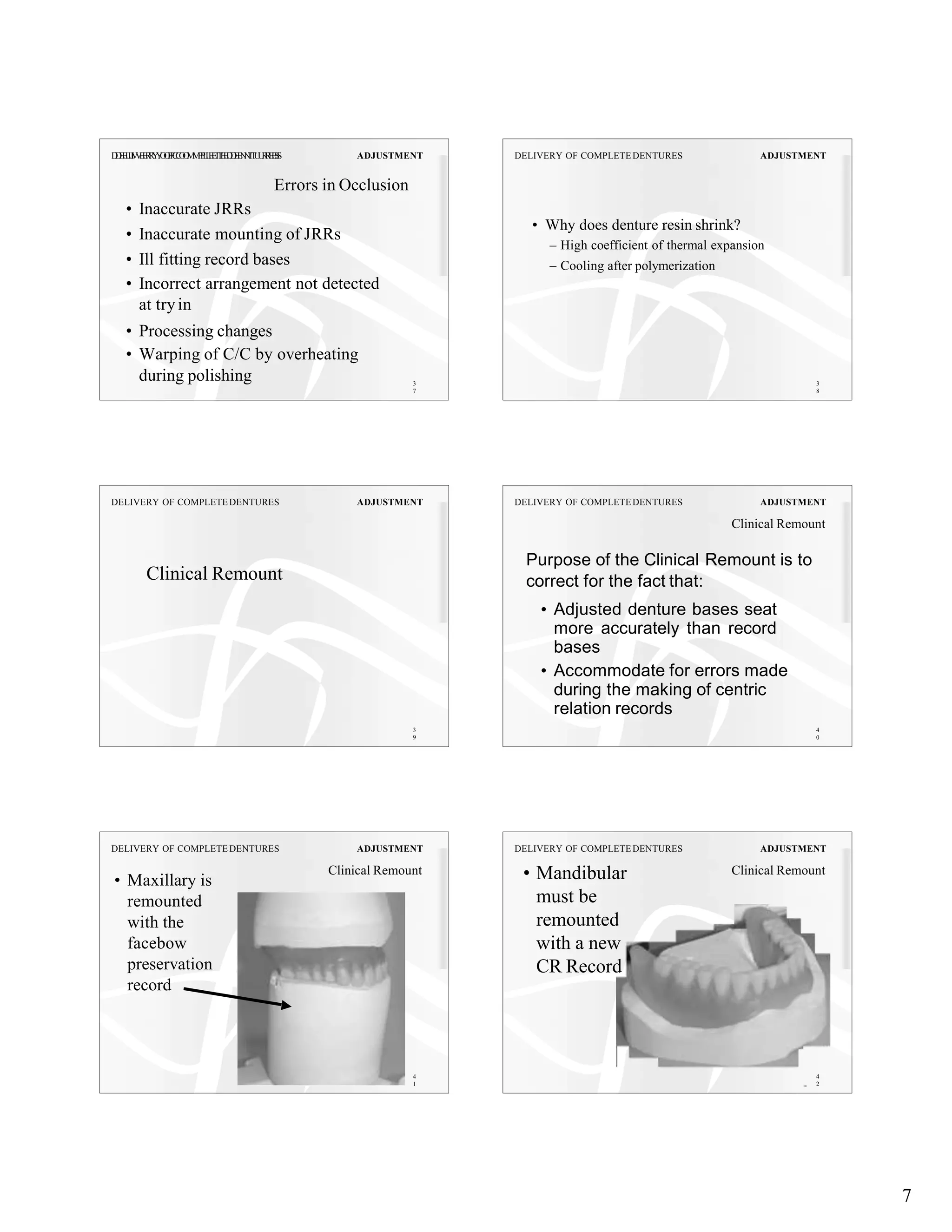 Denture delivery | PPTX
