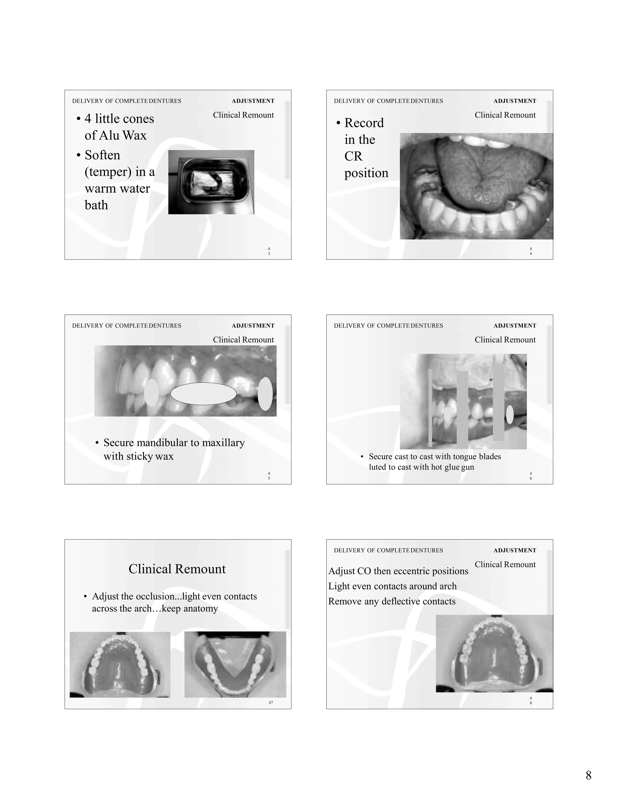 Denture delivery | PPTX