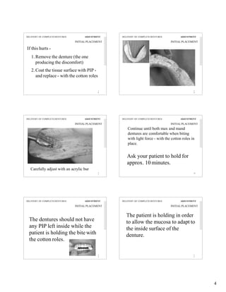 Denture delivery | PPTX