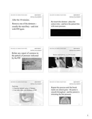 Denture delivery | PPTX