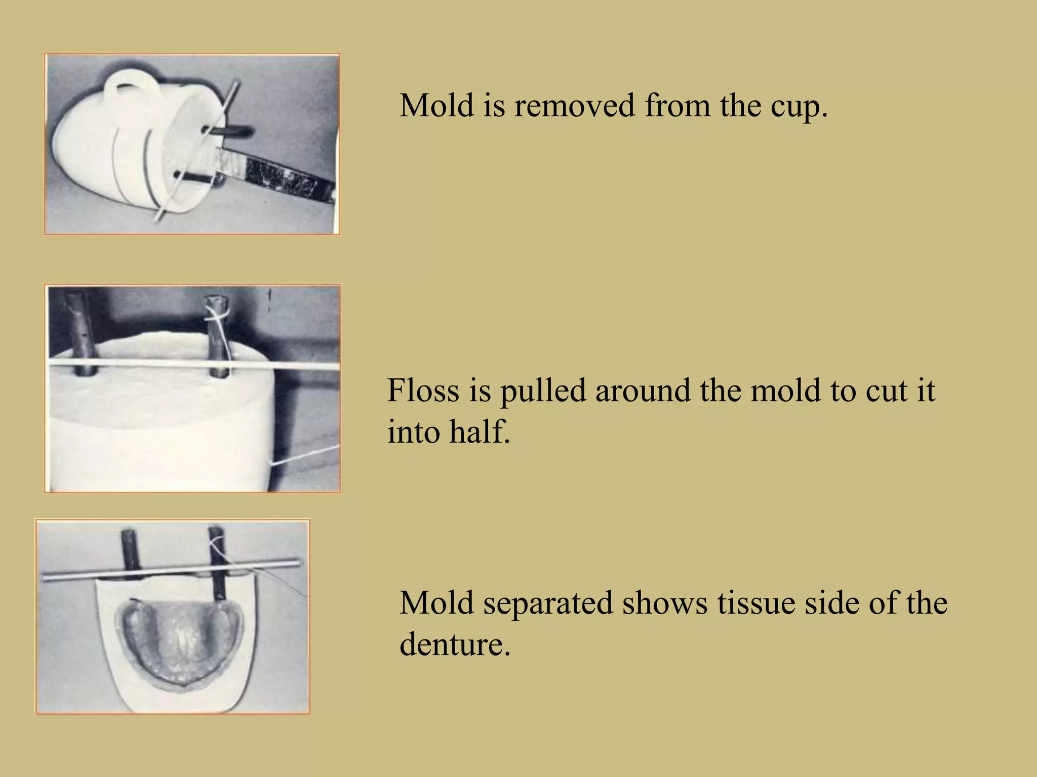 Denture duplication_112502.ppt