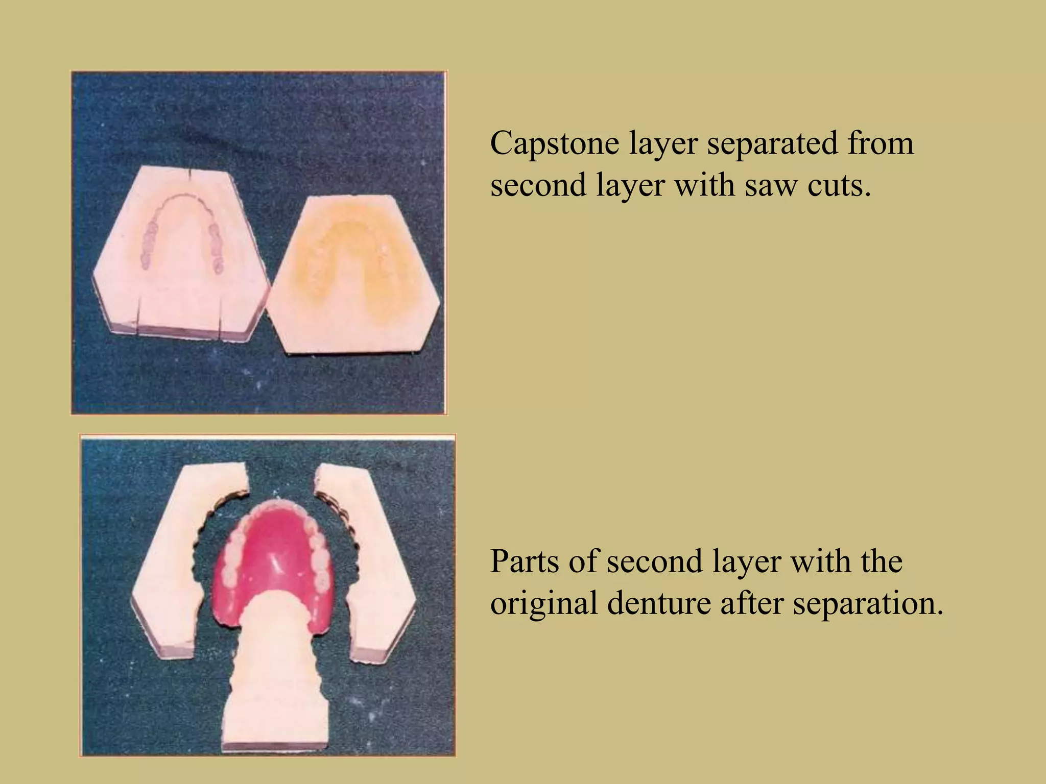 Denture duplication_112502.ppt