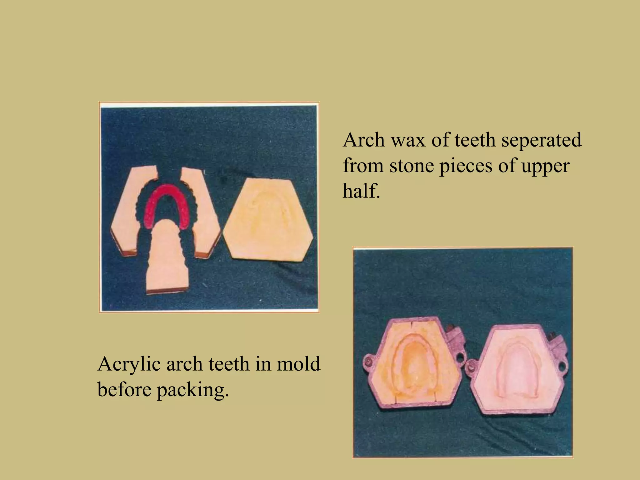 Denture duplication_112502.ppt