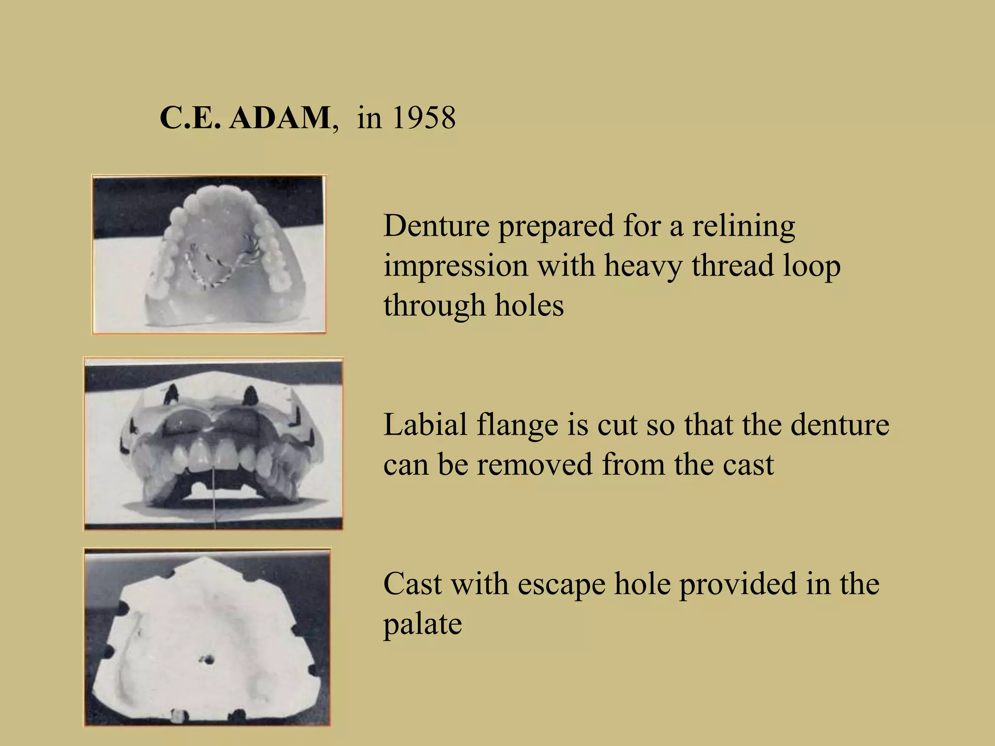 Denture duplication_112502.ppt