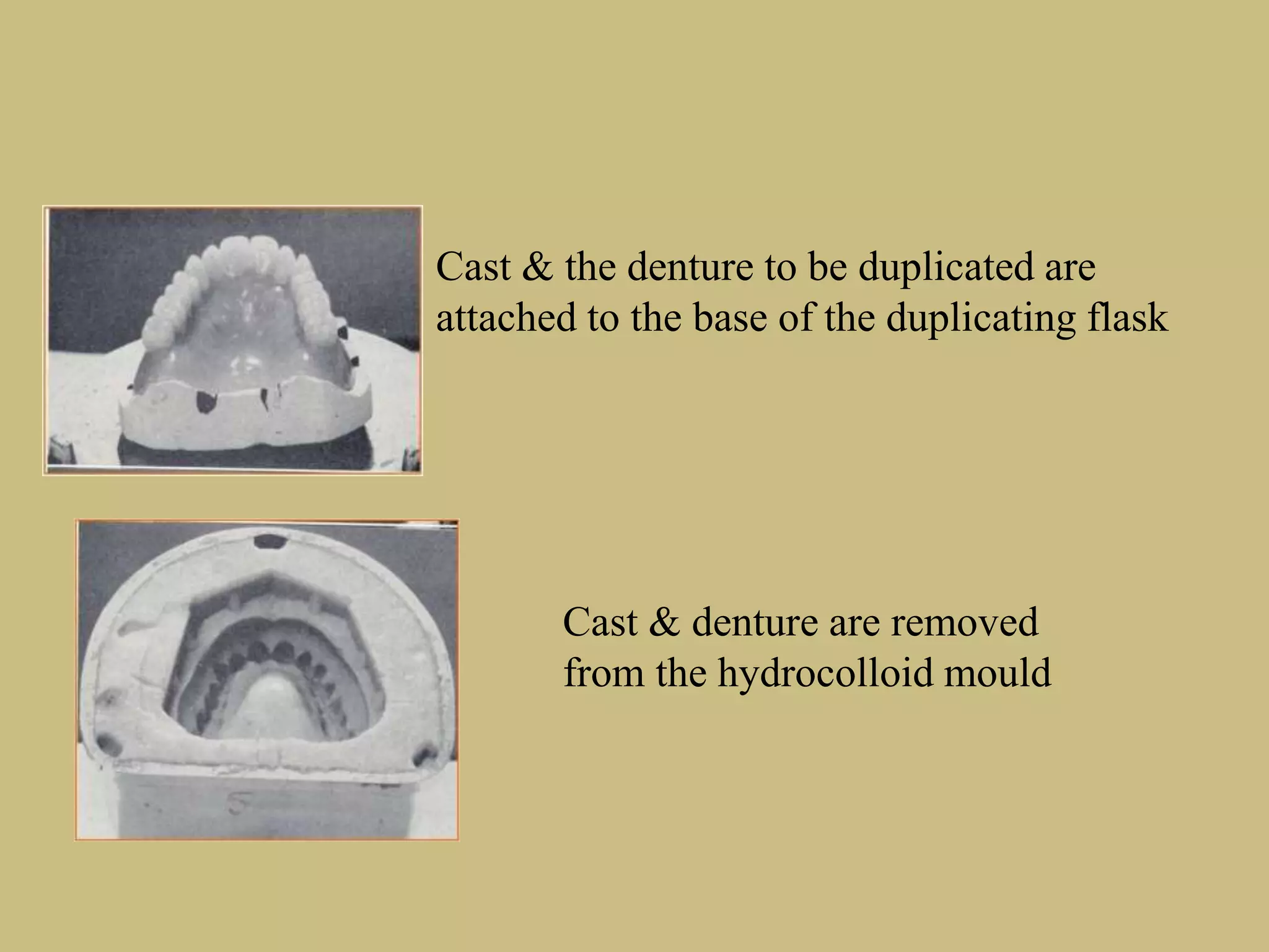 Denture duplication_112502.ppt