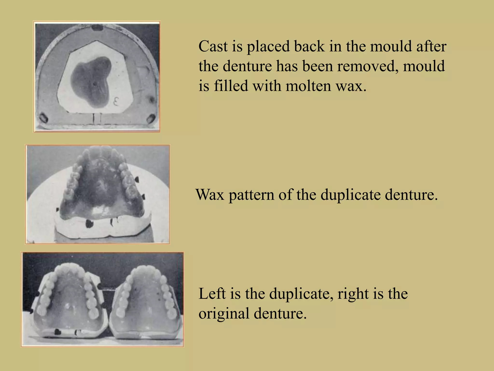 Denture duplication_112502.ppt