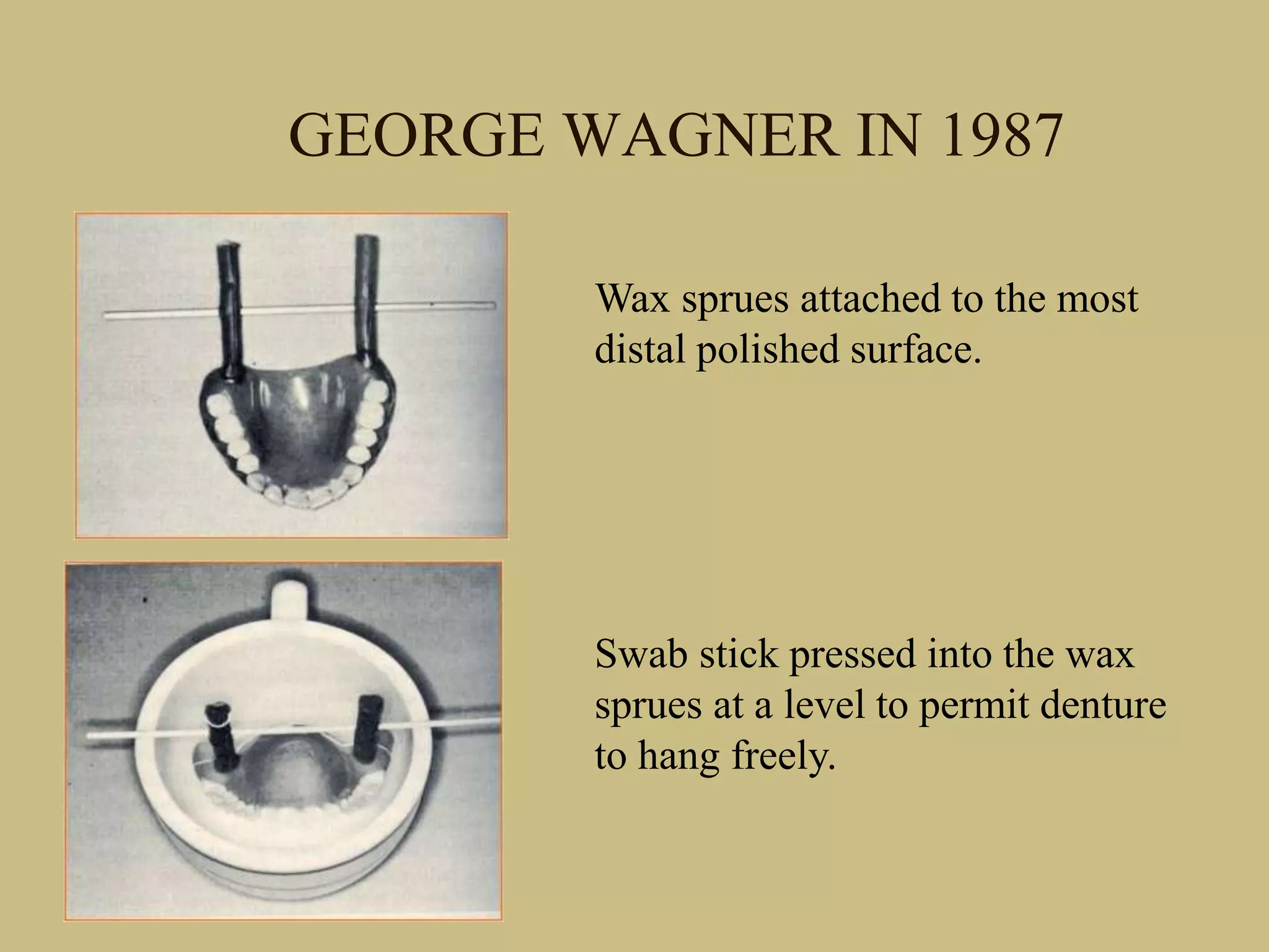 Denture duplication_112502.ppt