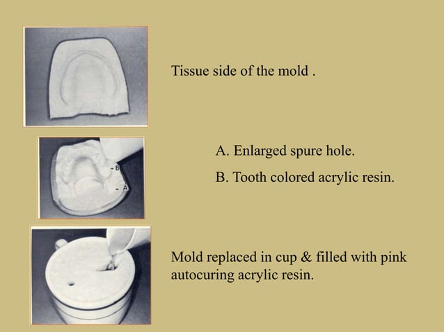 Denture duplication_112502.ppt