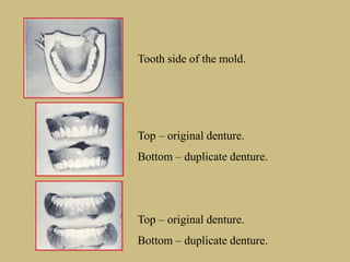 Denture duplication_112502.ppt