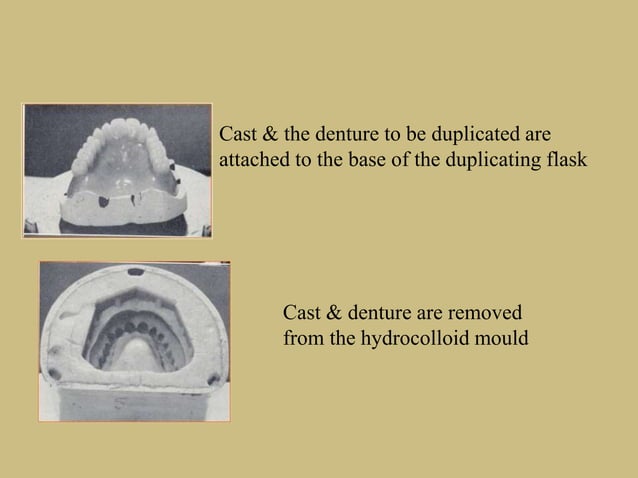 Denture duplication_112502.ppt