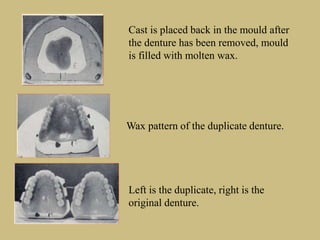 Denture duplication_112502.ppt
