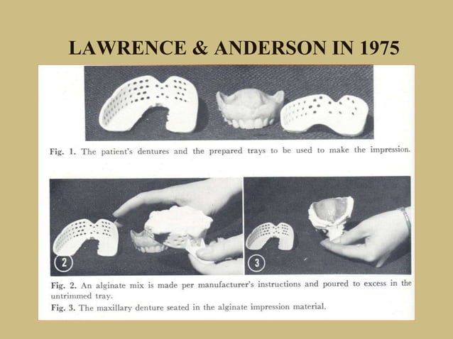 Denture duplication_112502.ppt