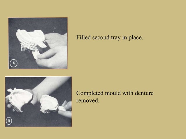 Denture duplication_112502.ppt